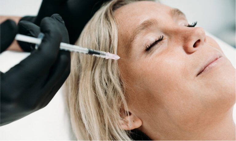 Temple Filler Treatment In London - Perfect Skin Studio