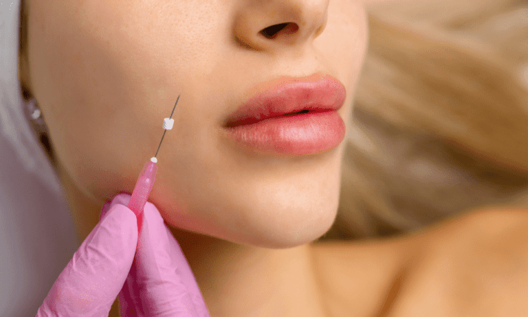 Profhilo Vs Fillers: Which Is The Best Option? - Perfect Skin Studio