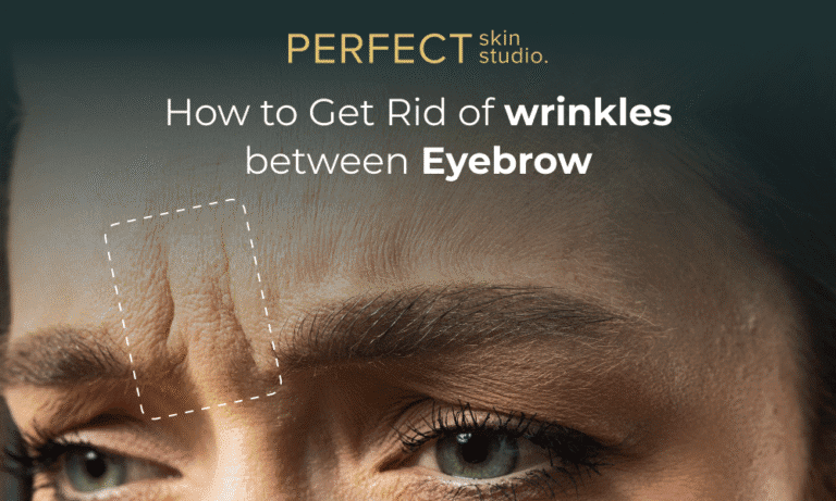 Crease Between Eyebrows: Causes, Treatments & Prevention